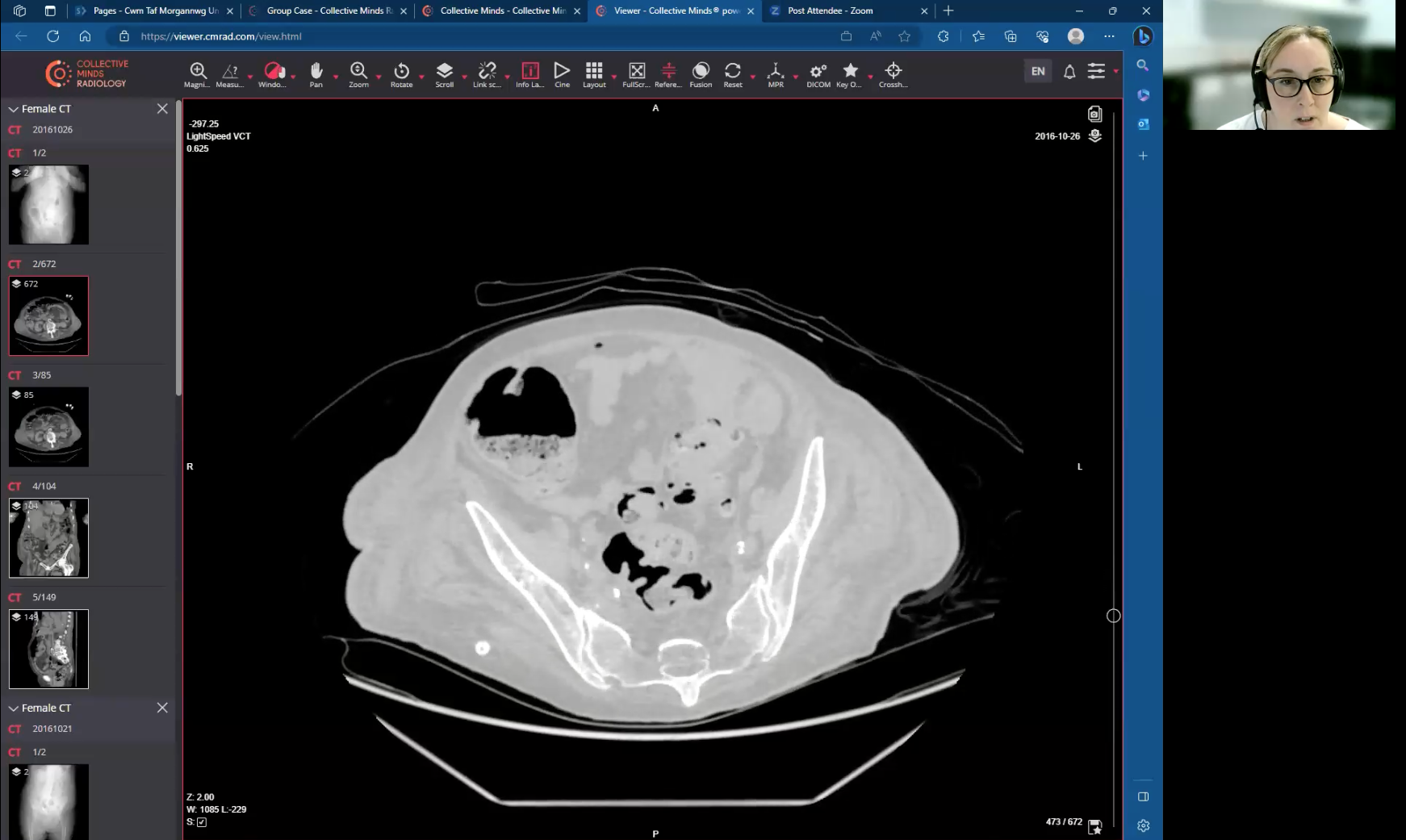 CT Colonography Course (On demand)