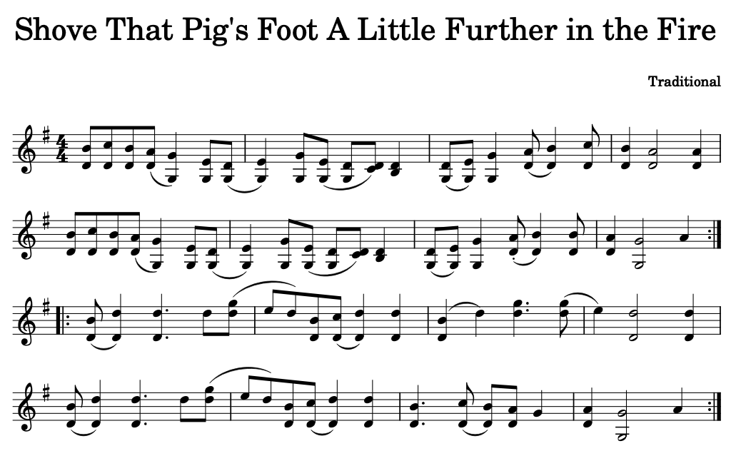 Sheet music collection: advanced transcriptions