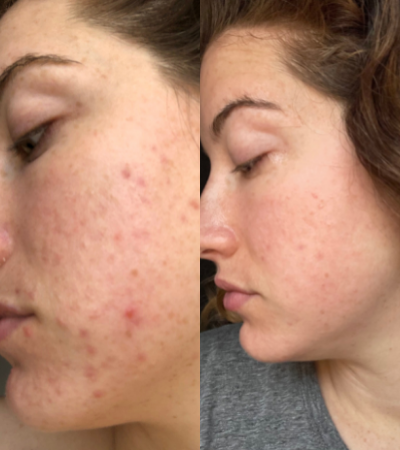 Skin Rebalancing Protocol