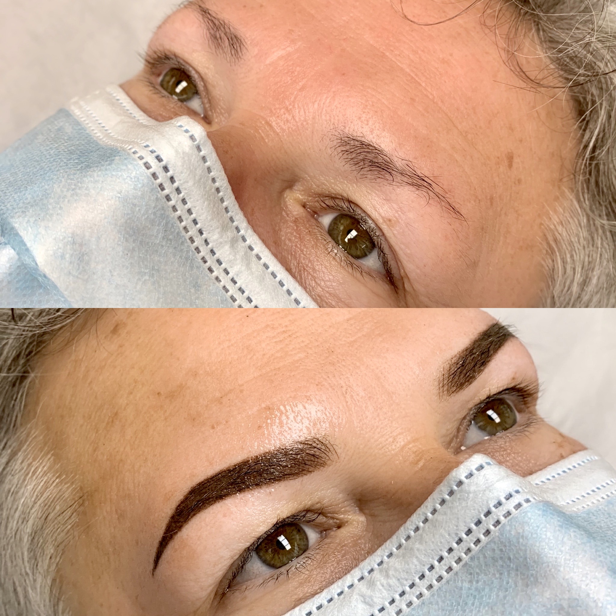 Micropigmentation