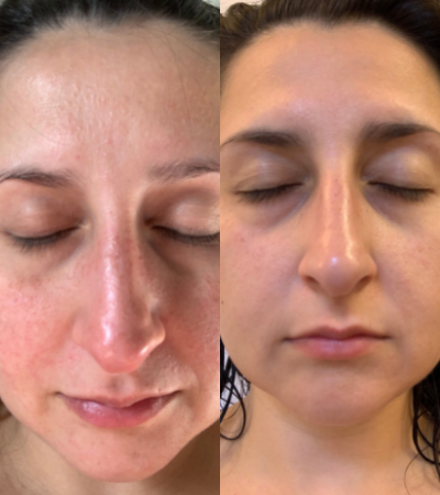 Skin Rebalancing Protocol