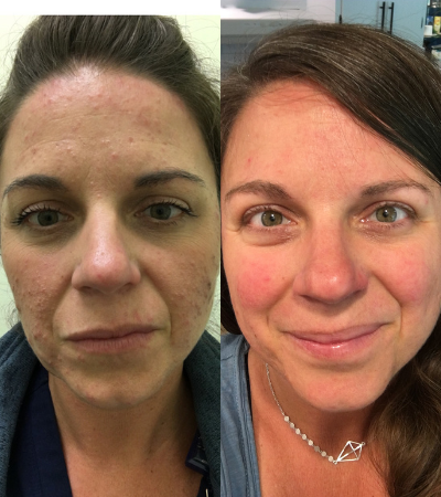 Skin Rebalancing Protocol