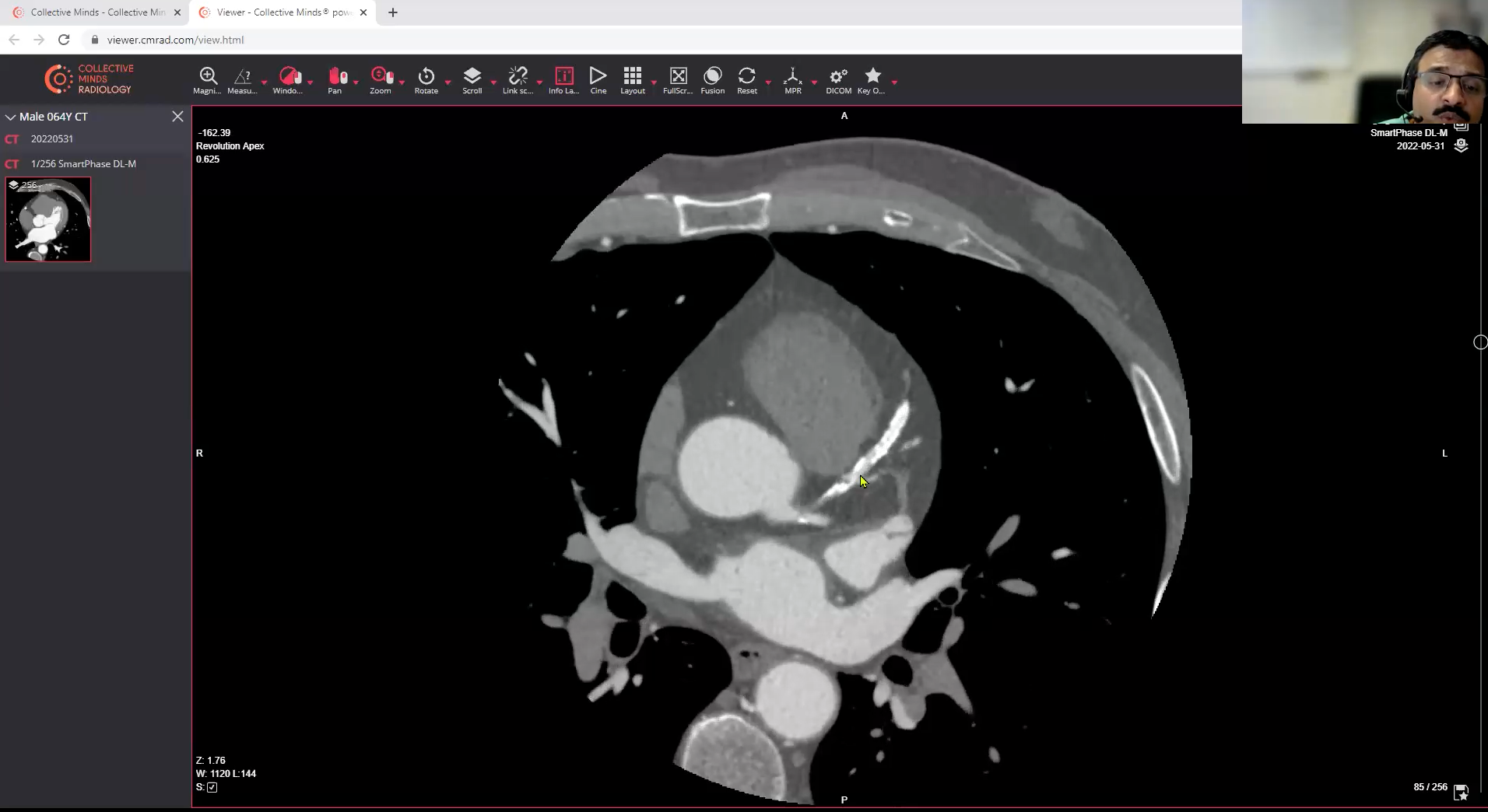 Cardiac CT Course (On demand)